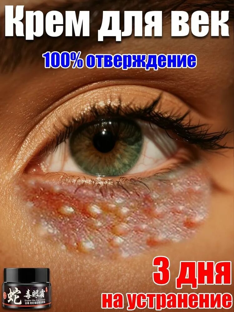 Средство от милиумов на лице, ретидерм крем для век антивозрастной, натуральный крем для удаления липомы Быстро удаляет подкожную липому, показан при отечности кожи, целлюлите, фиброзном жировике