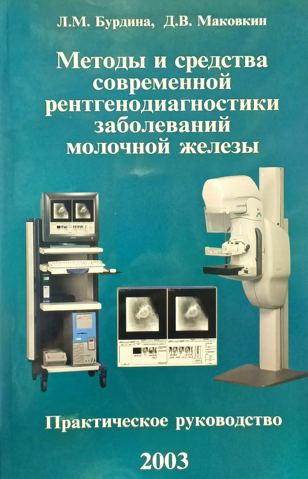 Методы и средства современной рентгенодиагностики заболеваний молочной железы. Л. М. Бурдина