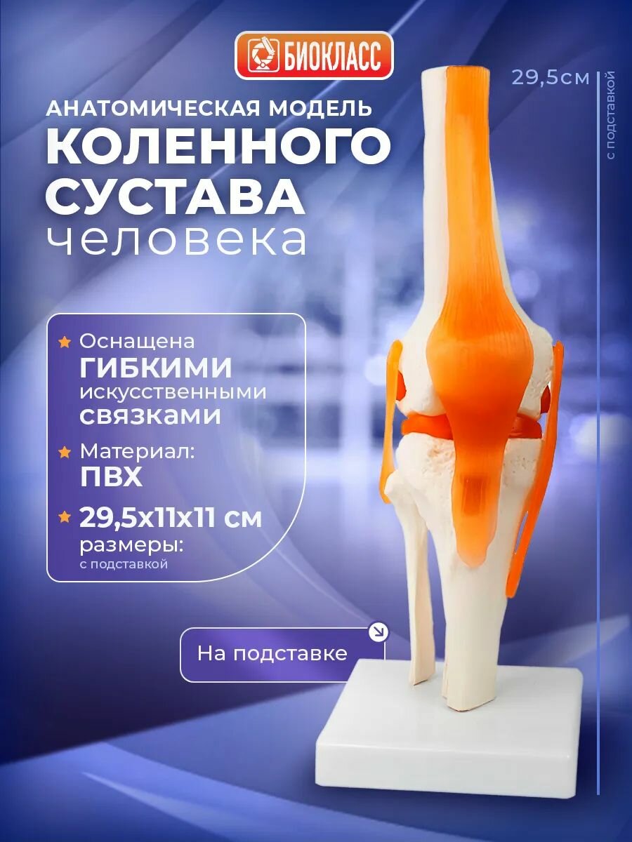Модель коленного сустава человека на подставке