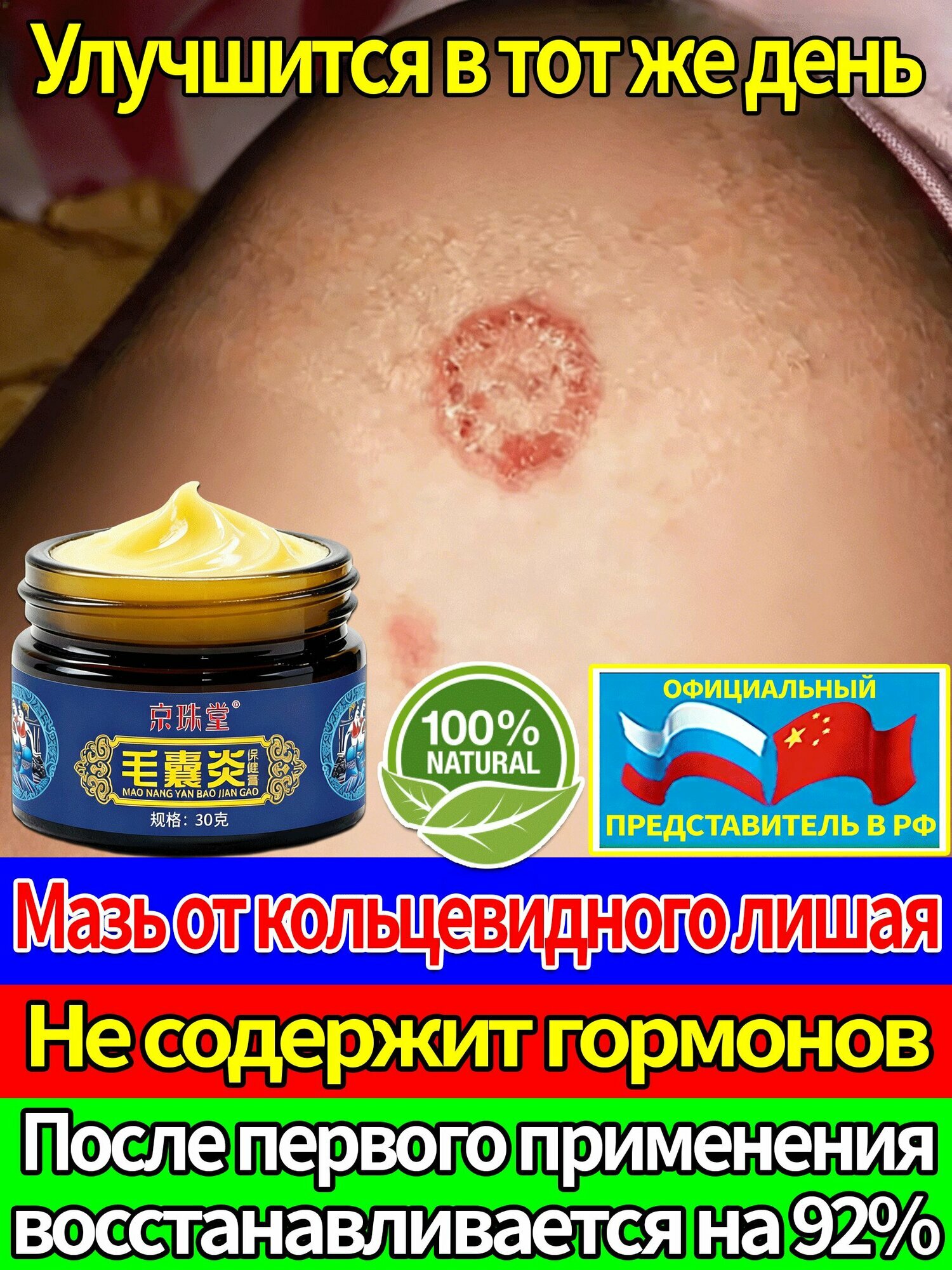 Мазь от лишая для человека