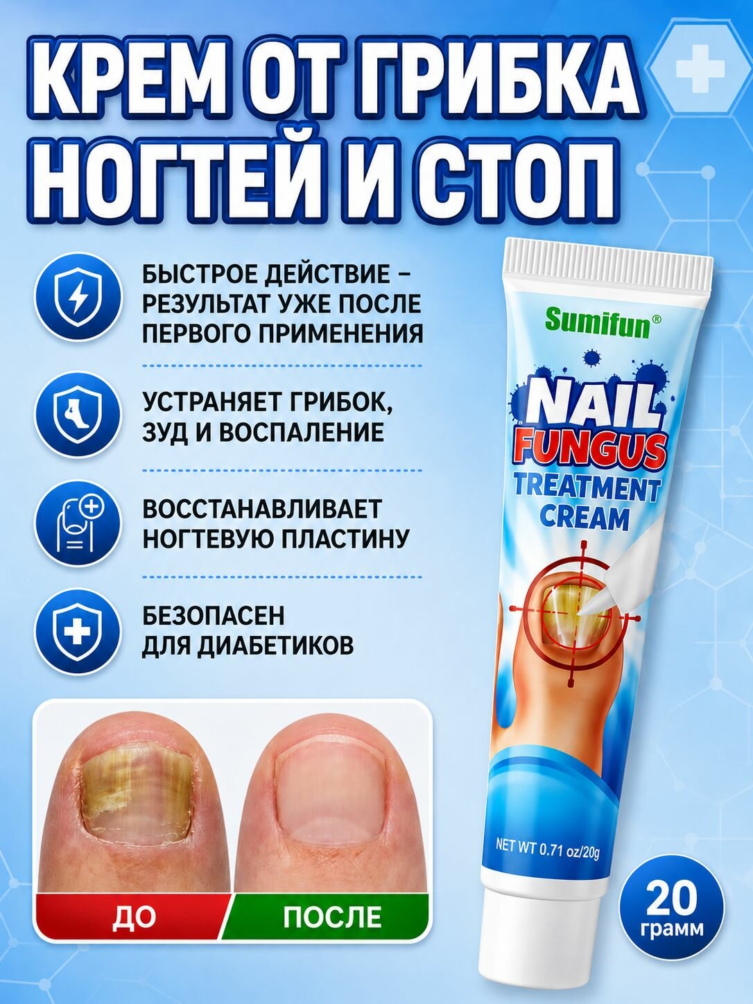 Мазь от грибка ногтей и стоп, крем от грибка ногтей