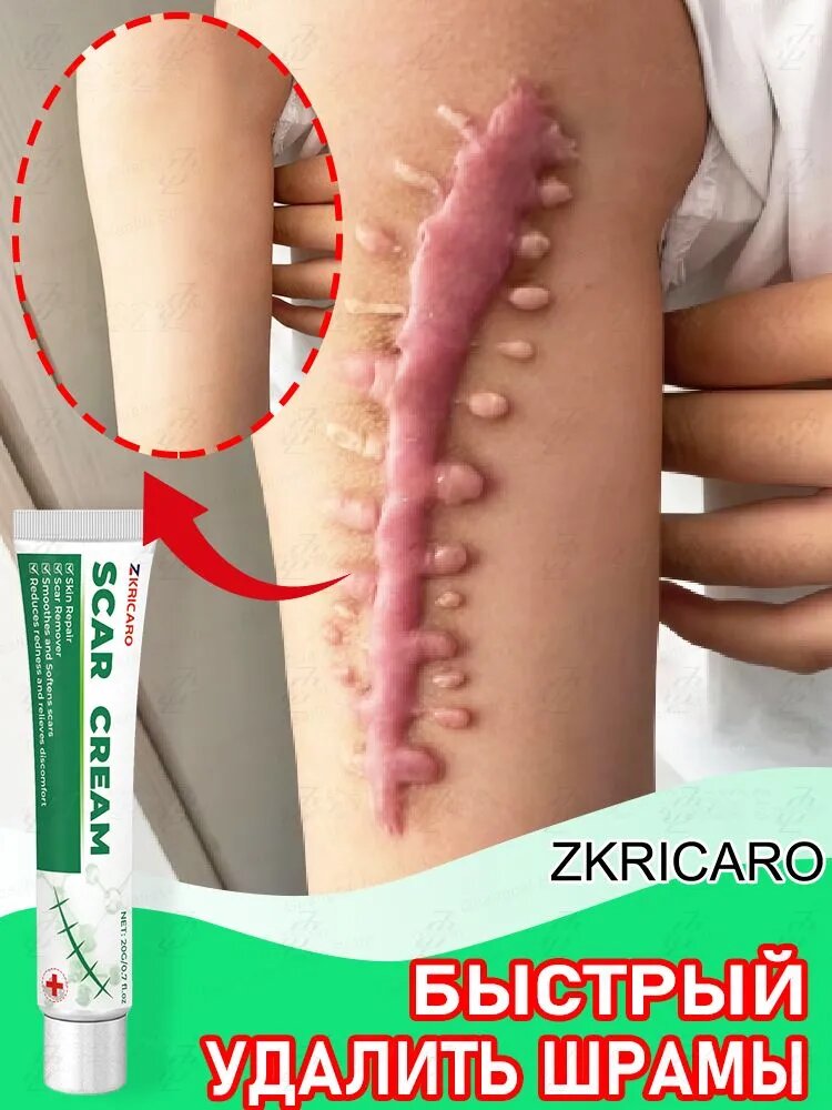 Гель от шрамов и рубцов / Крем от растяжек, от постакне, для осветления, восстановление, от ожогов, силиконовый гель / 20 g