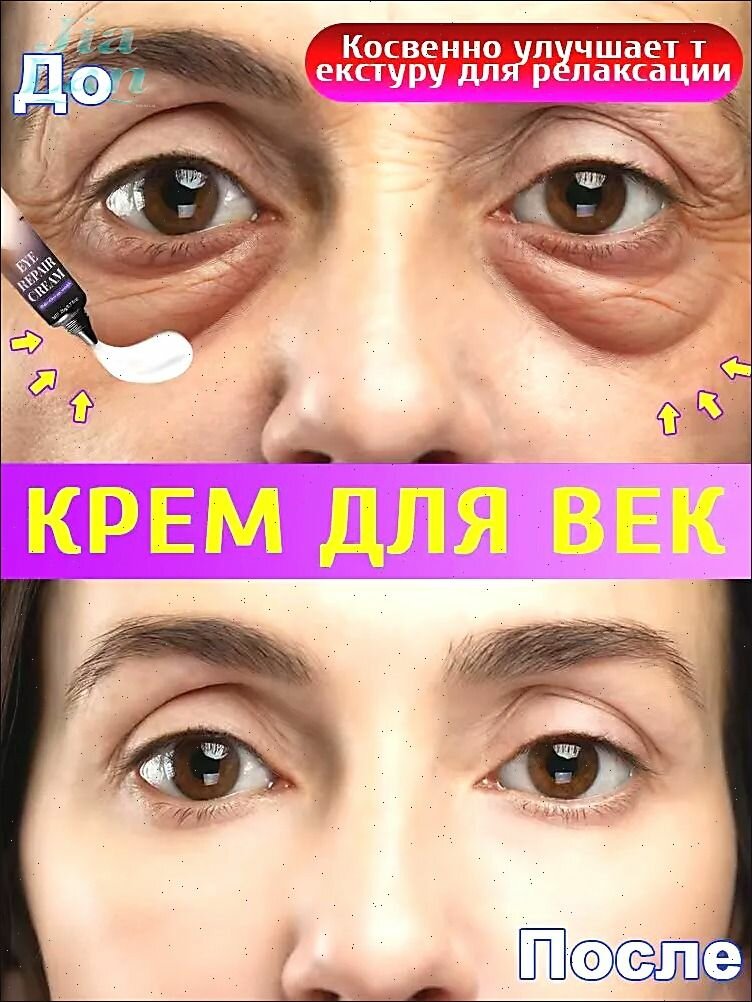 Крем для глаз. Устраните темные круги, мешки под глазами, отечность, выделение меланина, морщины и восстановите молодость и жизненную силу.20 мл