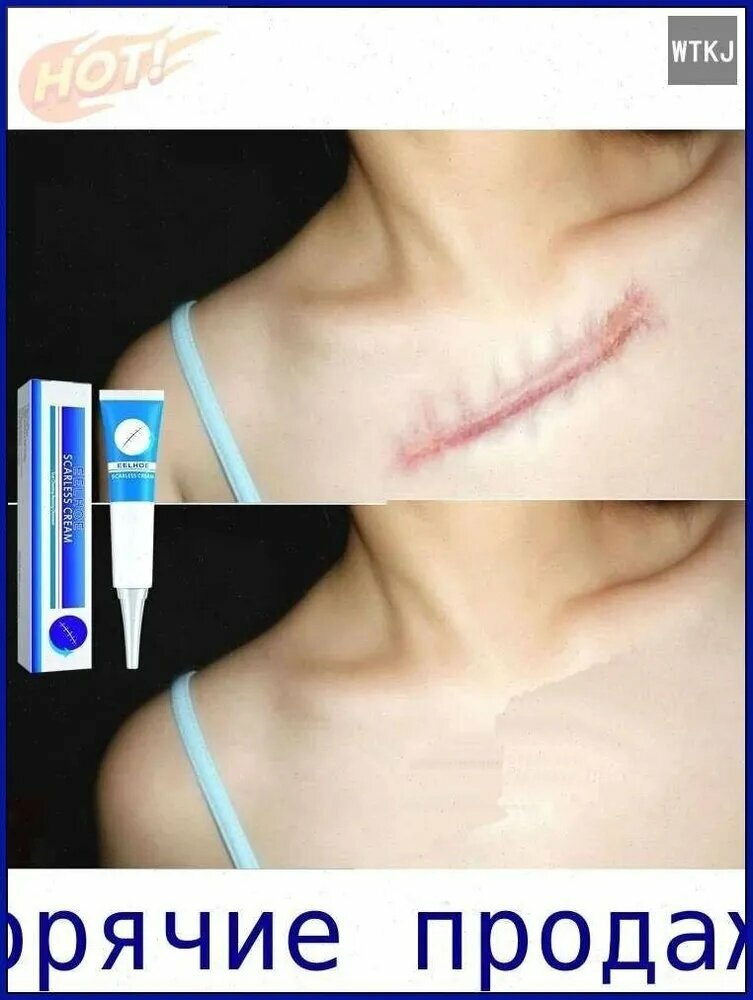 Крем Контрактубекс для восстановления кожи: эффективное средство от шрамов, растяжек и ожогов, нежный уход за кожей.