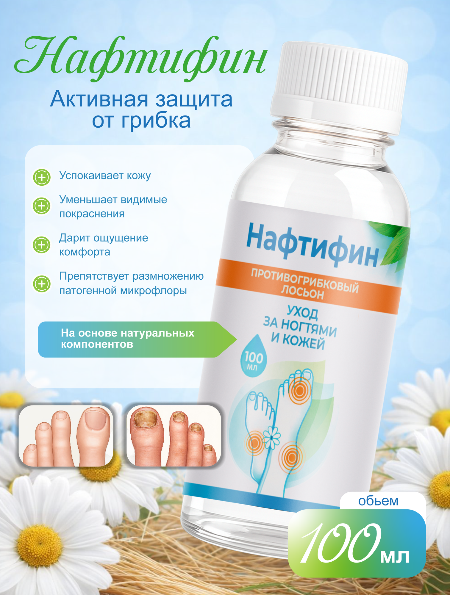 Противогрибковое средство "Нафтифин" на основе натуральных компонентов