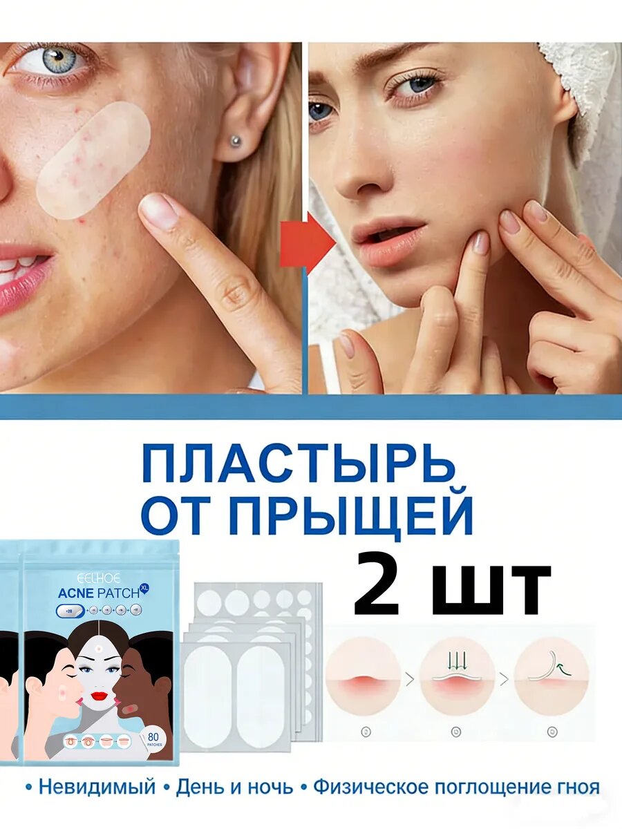 Водонепроницаемый патчи от прыщей и акне с маслом чайного дерева и календулой, 2 шт