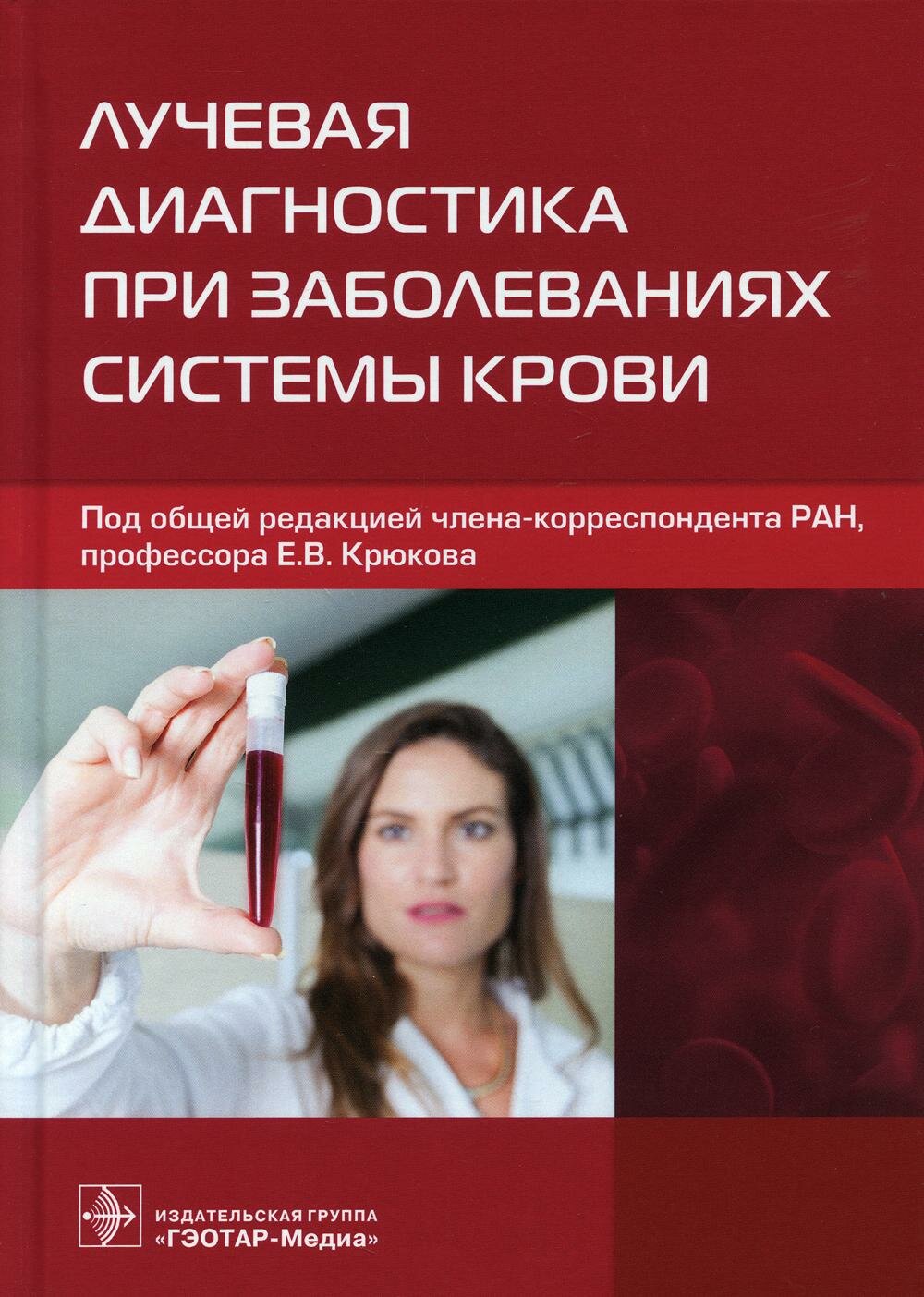 Уценка Лучевая диагностика при заболеваниях системы крови. Под ред. Крюкова Е.В. гэотар-медиа
