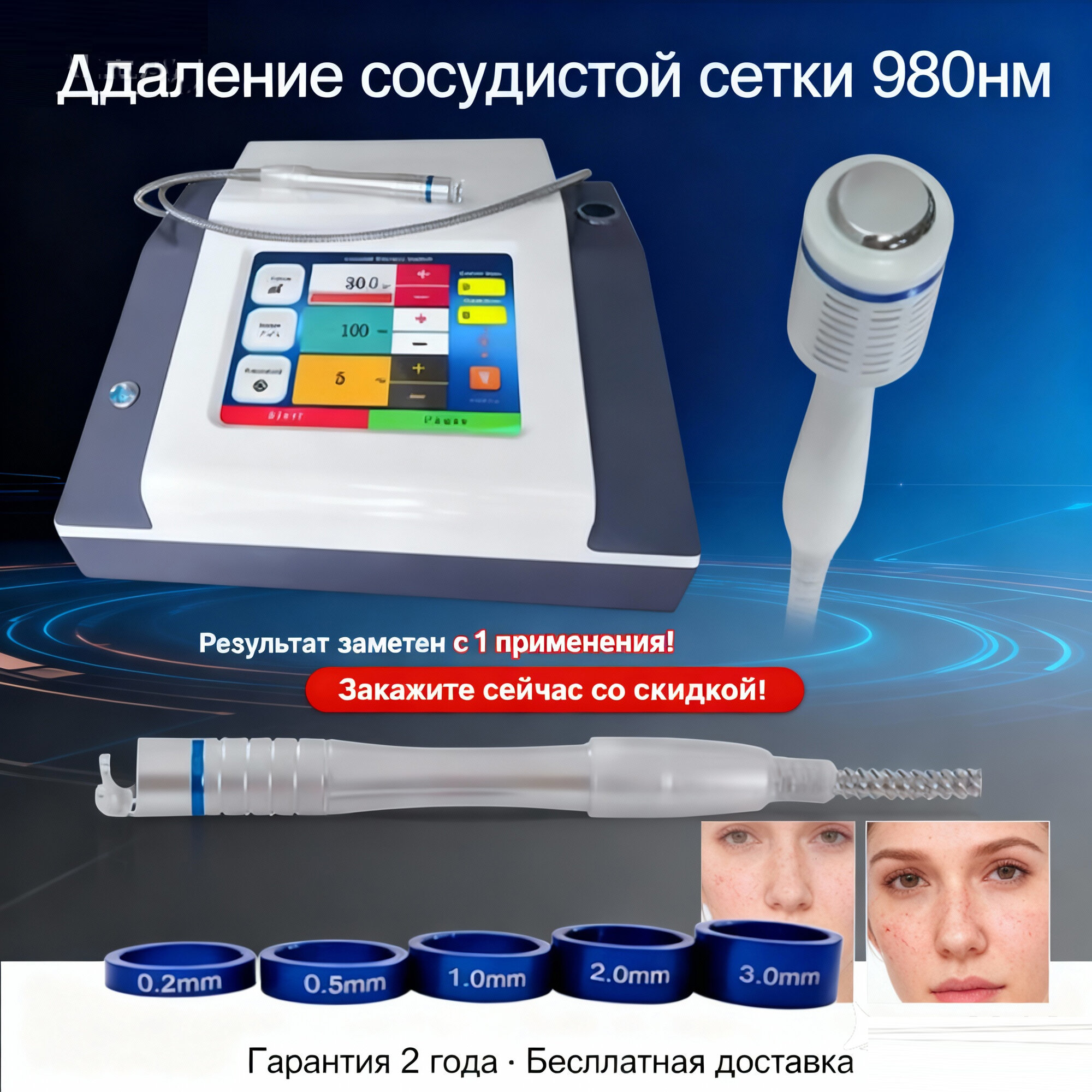 Лазер 980 нм для удаления красных кровяных нитей на лице, прибор для успокоения кожи.