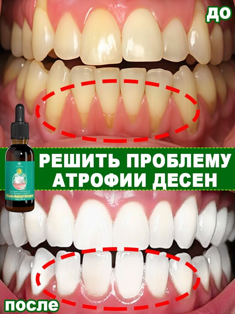 Эфирные масла для ухода за полостью рта при атрофии десен, чувствительности зубов, стоматите и уходе за деснами. Растительные экстракты. Антибактериальные средства по уходу за полостью рта.30 мл