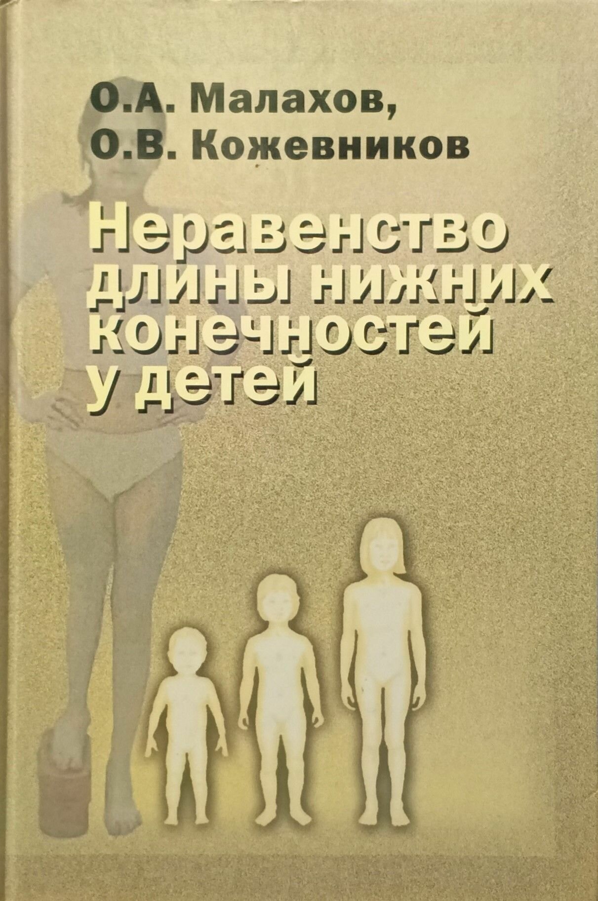 Неравенство длины нижних конечностей у детей. Малахов