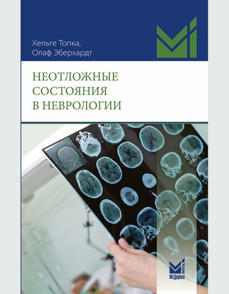 Неотложные состояния в неврологии