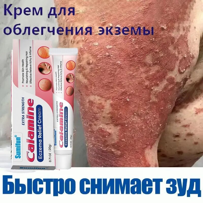 Sumifun Calamine Крем для облегчения экземы 20 г - быстро снимает зуд, для ухода за кожей