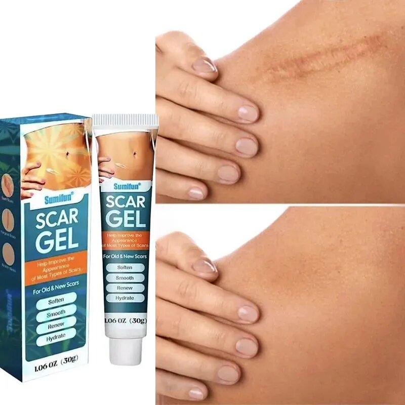 Sumifun Scar Gel Гель для ухода за кожей от рубцов, растяжек, пигментных пятен, 30 мл, Китай