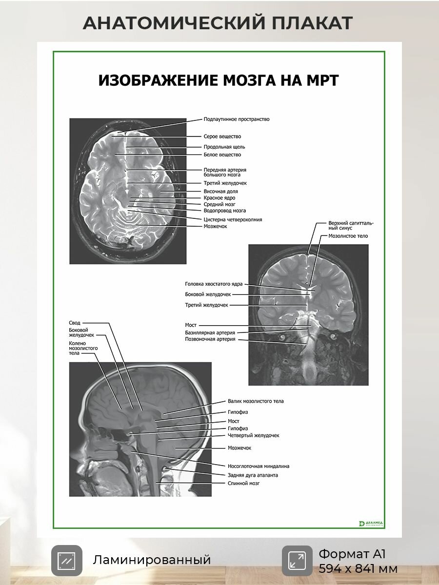 Обучающий медицинский плакат ламинированный формат А1 Изображение мозга на МРТ