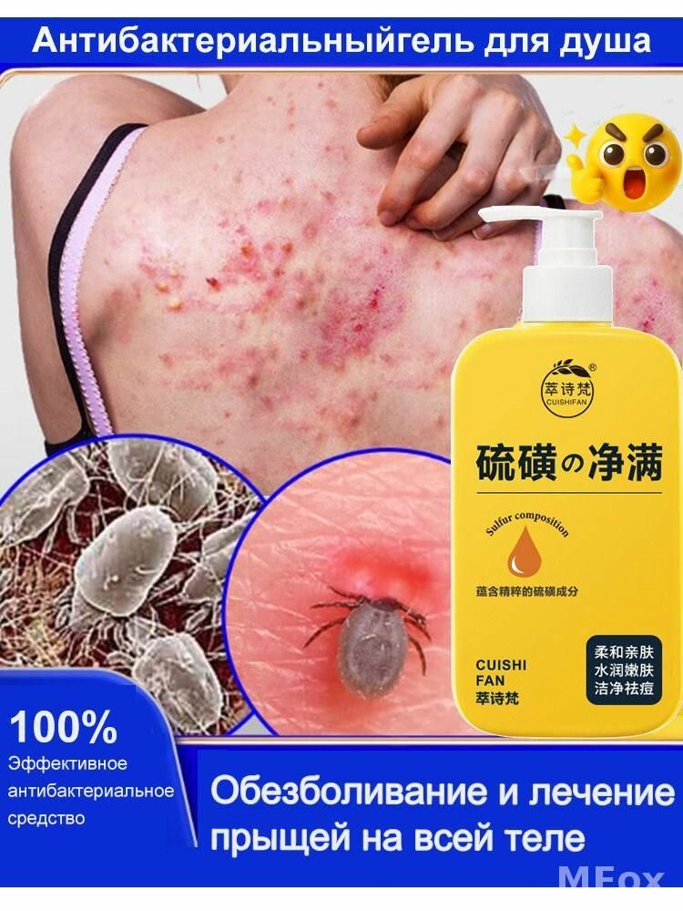 Серный гель для душа против клещей 300 мл. Специально для зуда кожи, угрей на спине, красных пятен и шишек. Успокаивает зуд, уничтожает клещей, с стойким ароматом.