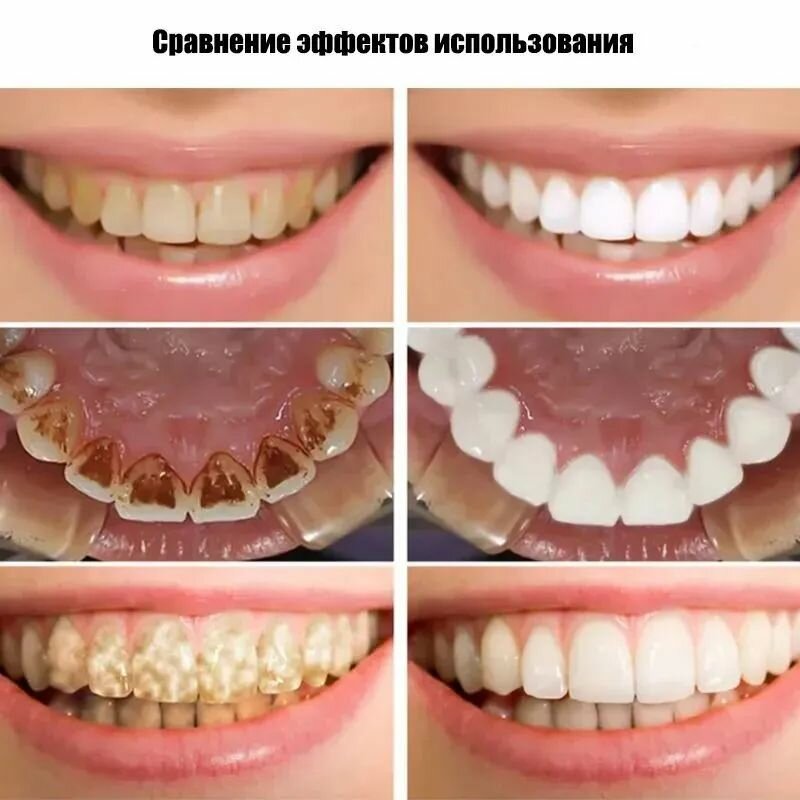 Кинотто лемонграсс зубная паста от зубного камня 99,1