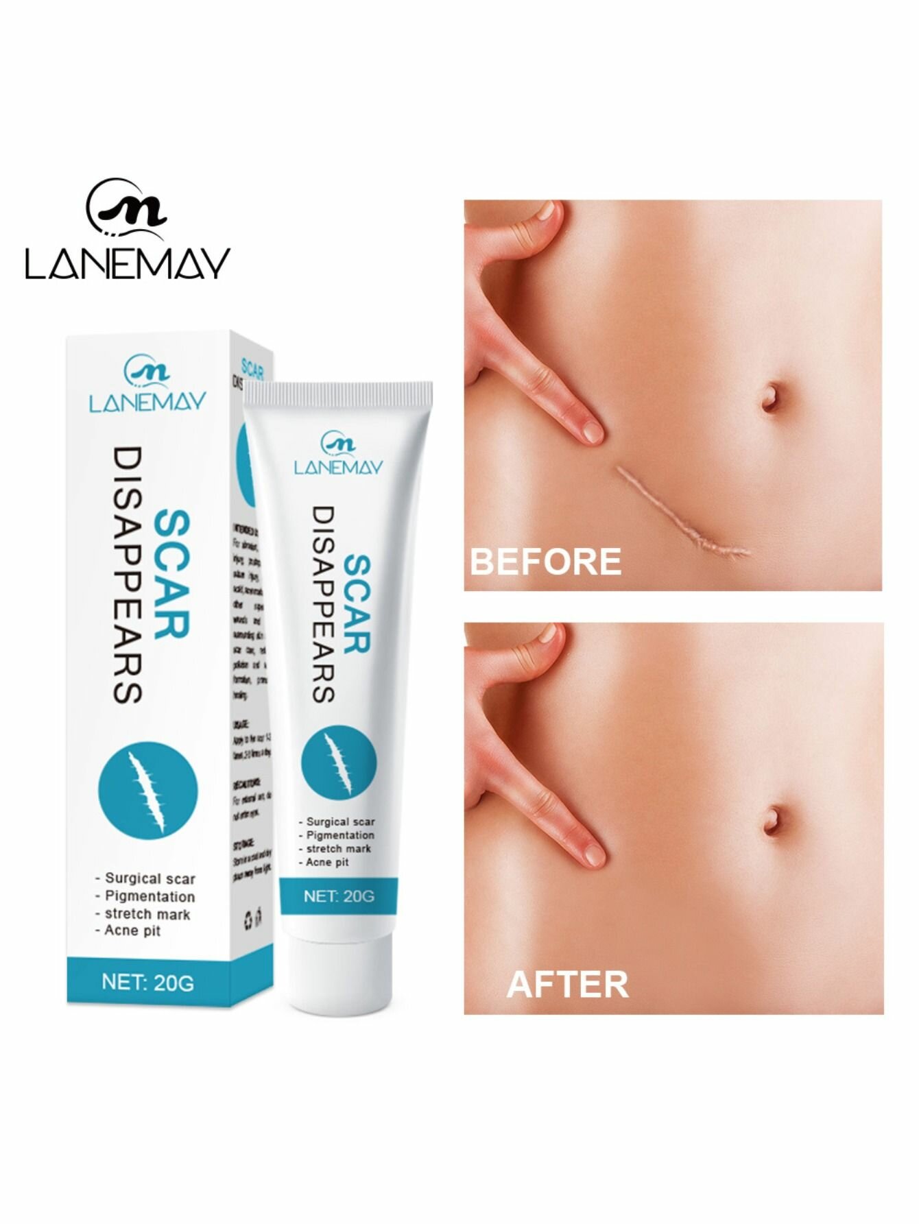 Мазь и охлаждающий гель для удаления рубцов