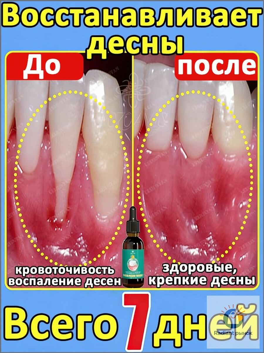 POZOAMIS-12 Ополаскиватель для полости рта 90.1 мл