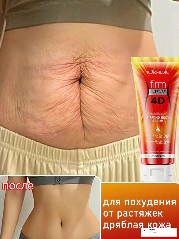 Эксклюзивный крем для моделирования фигуры, устранения растяжек и повышения упругости кожных покровов