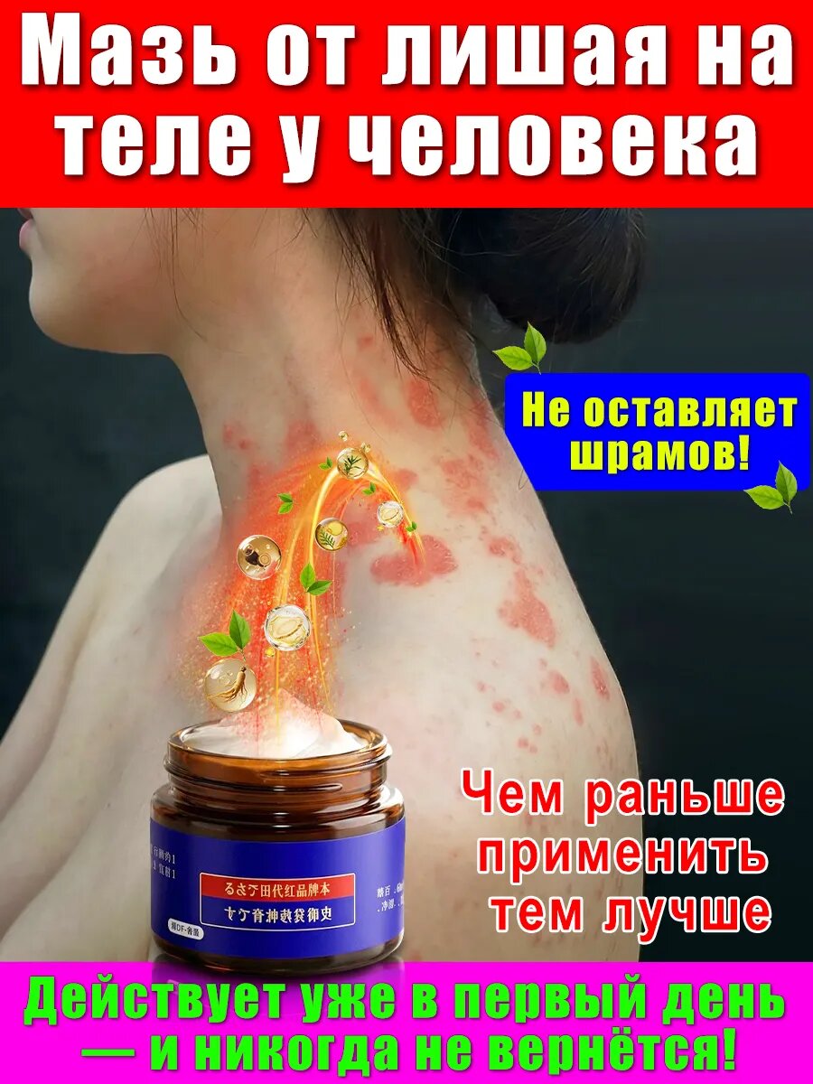 Мазь от лишая человеку на теле