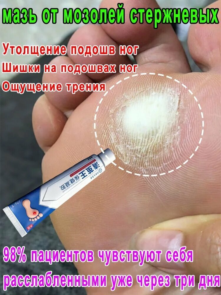 Препараты, используемые для лечения корневых мозолей, безопасны и не вызывают раздражения