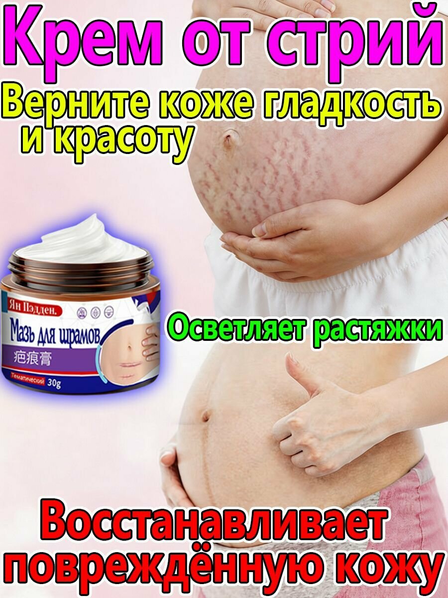 Крем от стрий роста
