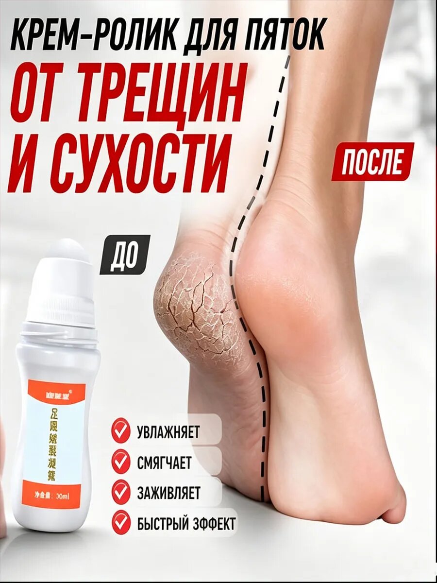 Крем для ног с мочевиной 30% от трещин