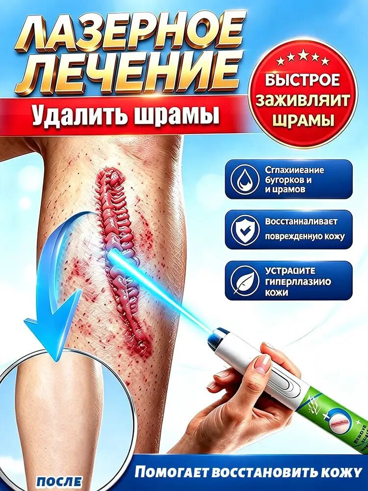 Лазерная указка для удаления шрамов устраняет шрамы, следы ожогов, растяжки и жировые отложения, предотвращает образование рубцов и восстанавливает кожу.1 упаковка.