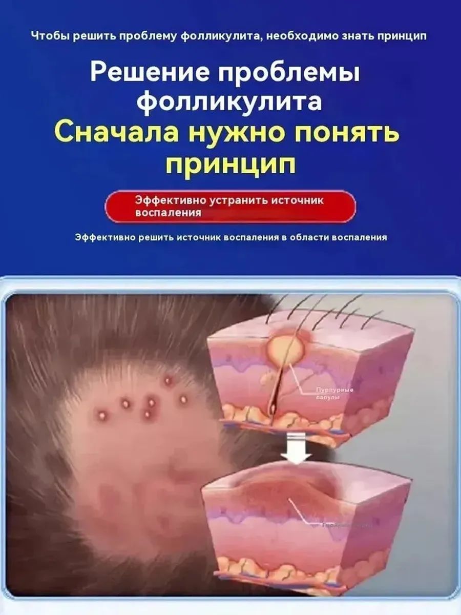Твердое мыло — фото 1