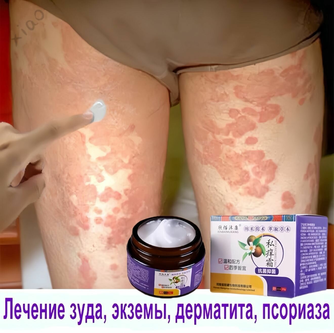 Крем против зуда, Крем антибактериальный 30г Чудо мазь для интимных зон против грибка от зуда, кандиды, снятия дискомфорта для мужчин и женщин