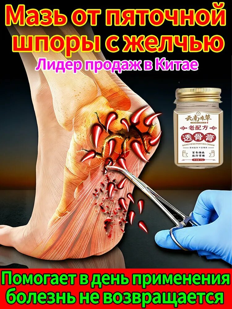 Мазь от пяточной шпоры с желчью 50г