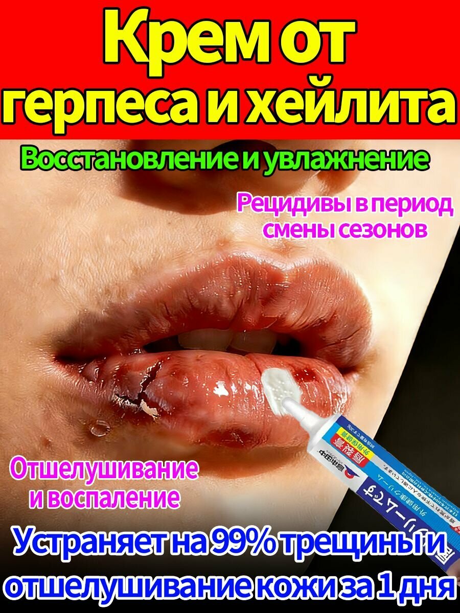 Крем от герпеса и хейлита, против трещин и сухости на губах