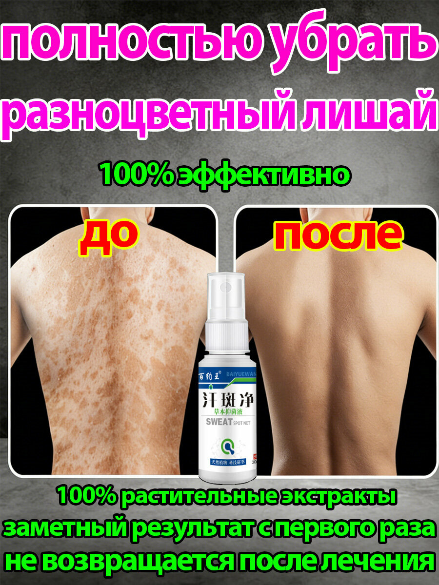 Специальное средство от разноцветного лишая Для восстановления разноцветного лишая От грибк