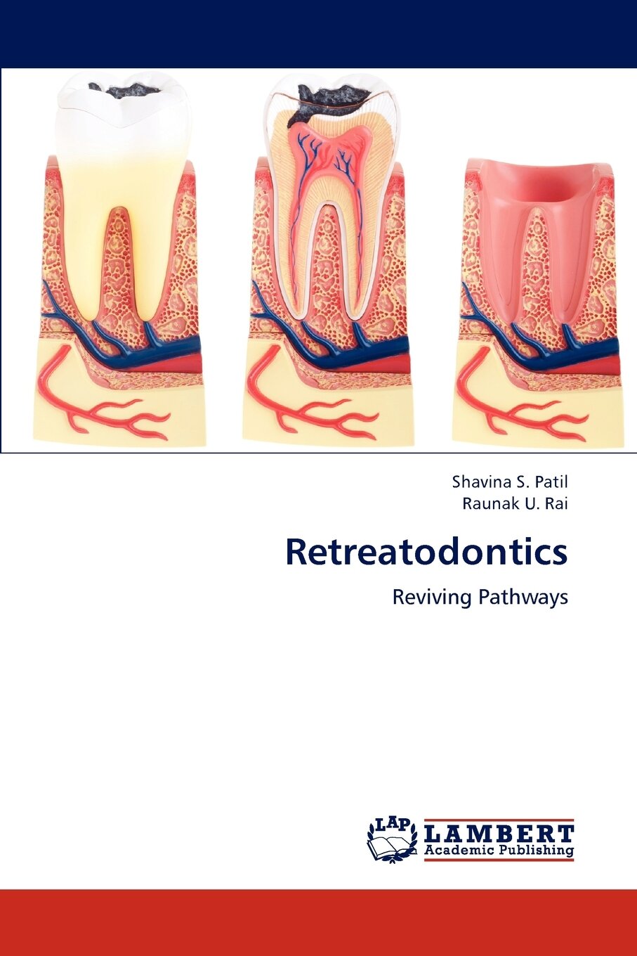 Retreatodontics — фото 1