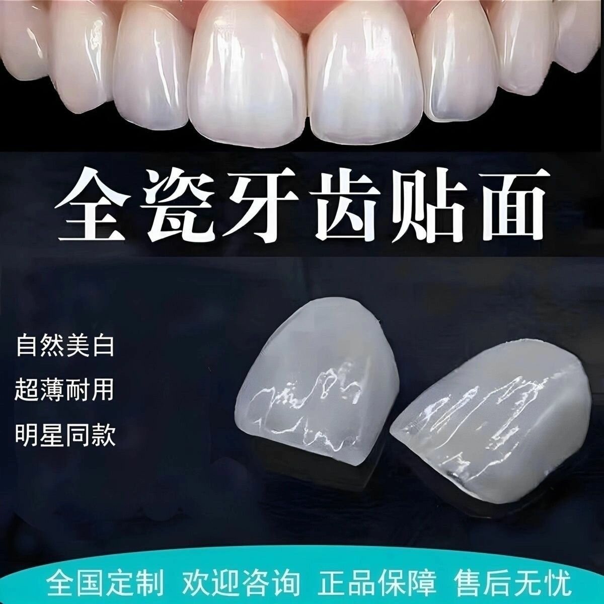 Отбеливающие полные керамические виниры, ультратонкие виниры для зубов, стиль знаменитостей TikTok, полные керамические виниры для зубов, индивидуальный заказ