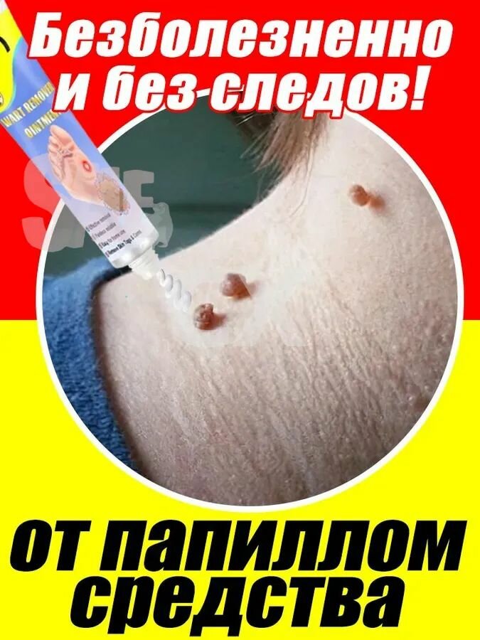Крем для безболезненного устранения плоских и нитевидных бородавок, папиллом, остроконечных кондилом, родинок и подошвенных бородавок ,60г