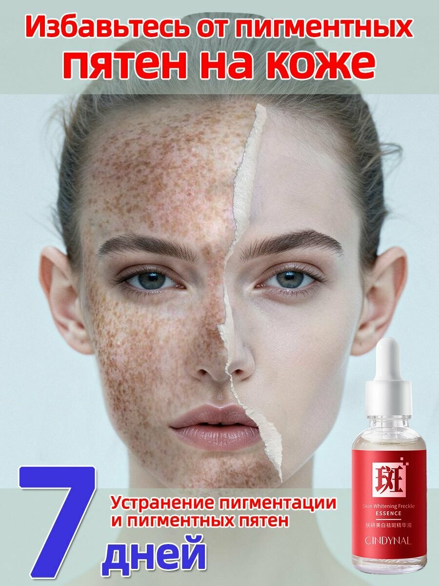Сыворотка для отбеливания и удаления пигментных пятен на лице, осветляет пигментацию, выравнивает тон кожи, подходит для мужчин и женщин, 30 гпомогает уменьшить проявление веснушек и тёмных пятен