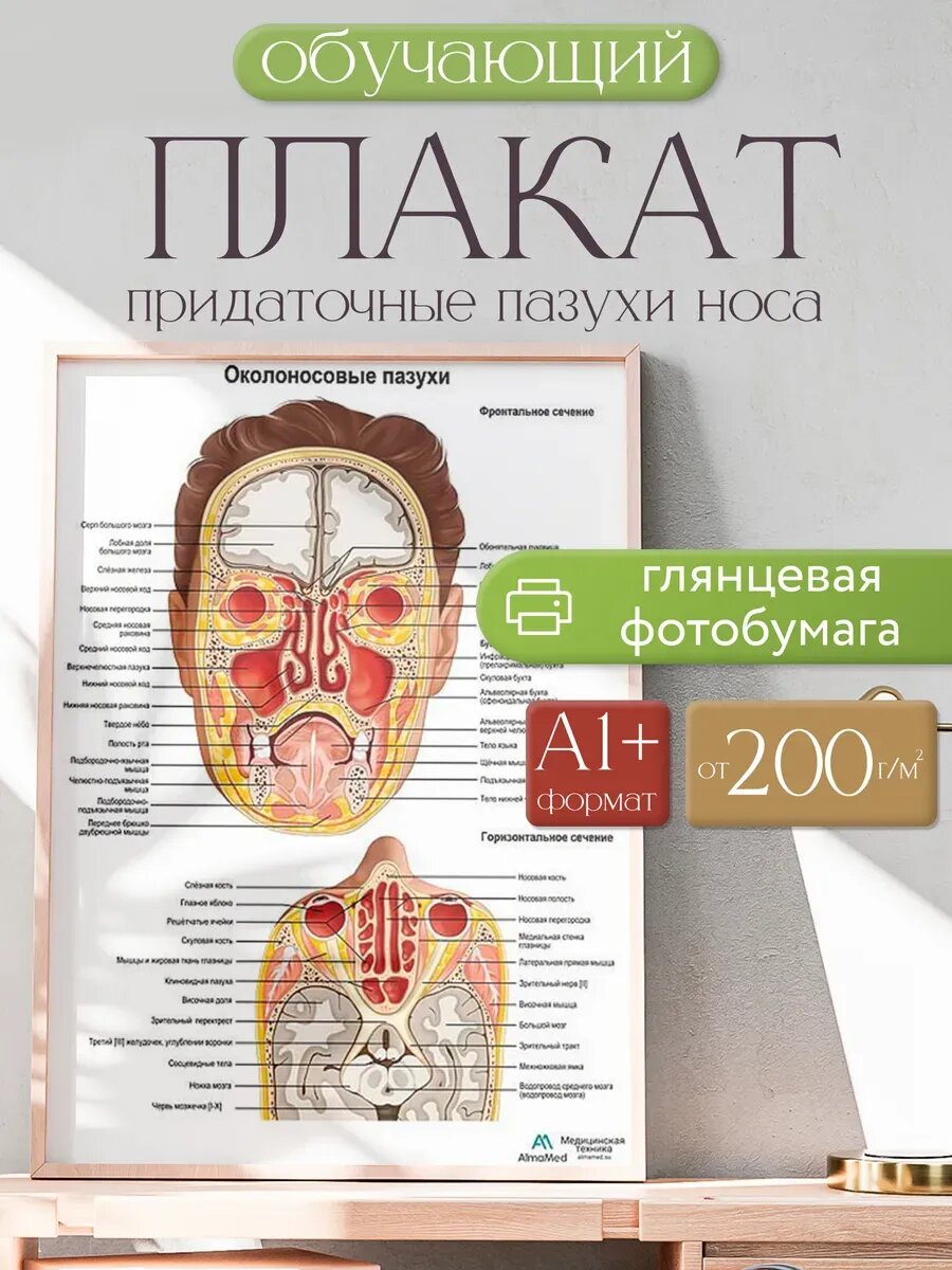 Обучающий плакат "Придаточные пазухи носа", размер А1+, глянцевая фотобумага от 200г/м2