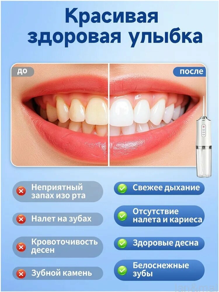 Ирригатор — фото 1