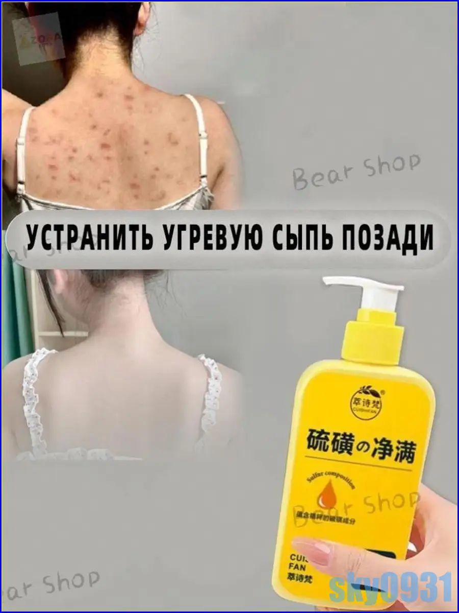 Серный гель для душа от клещей с экстрактом, 300 мл, антисептическое и заживляющее средство для тела