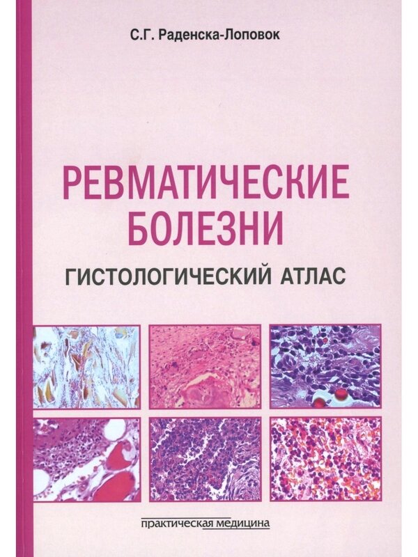Ревматические болезни. Гистологический атлас (Раденска-Лоповок С. Г.)