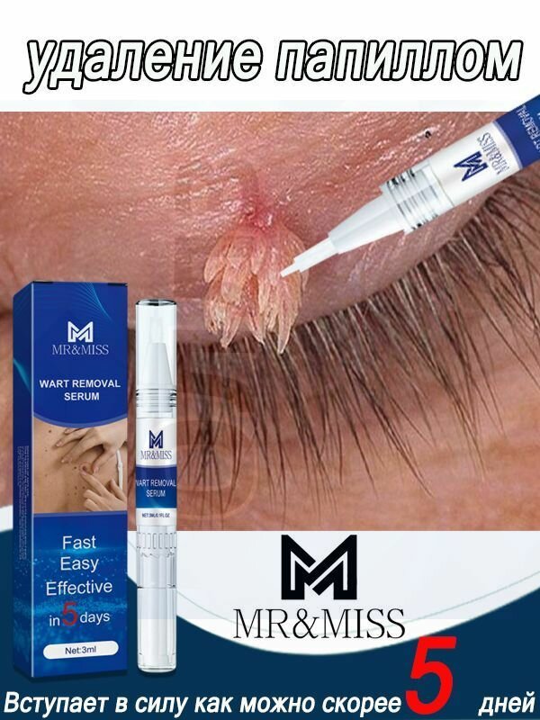 Карандаши для удаления бородавокдля лечения бородавок, средство от папиллом, от бородавок, от мозолей, безболезненный и не вызывающий раздражения / 3 мл