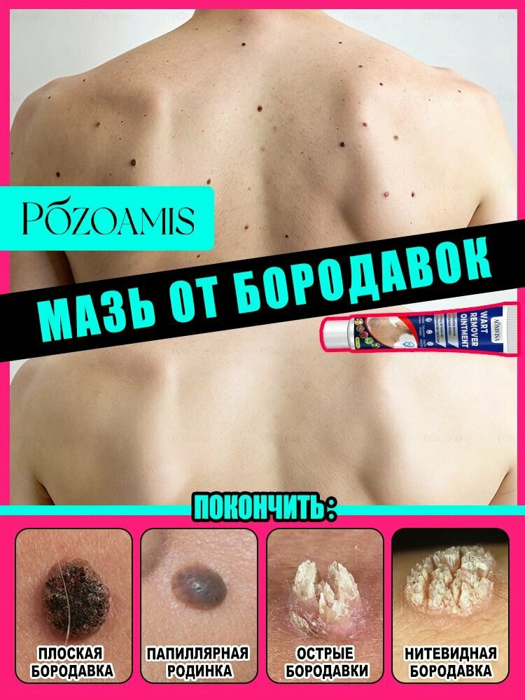 Мазь для удаления бородавок и папиллом, безболезненная и не оставляющая рубцов, подходит для всего тела, как для мужчин, так и для женщин.