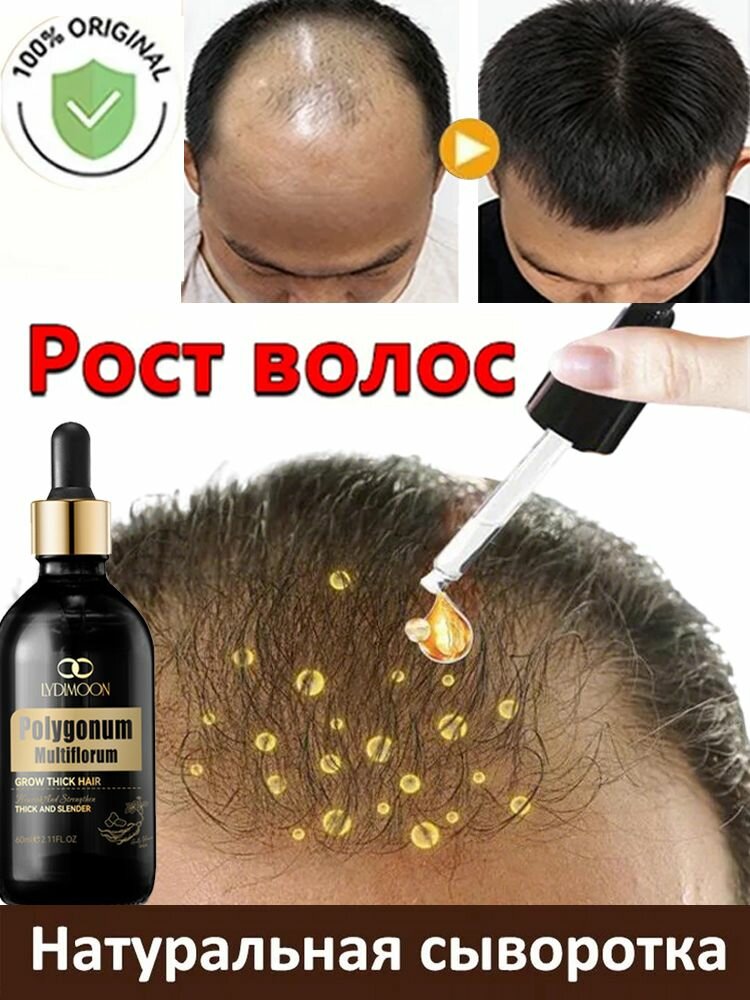 Сыворотка для волос, Используется для активизации роста волос, увеличения густоты, предотвращает выпадение и облысение, для женщин и, мужчин 50 мл