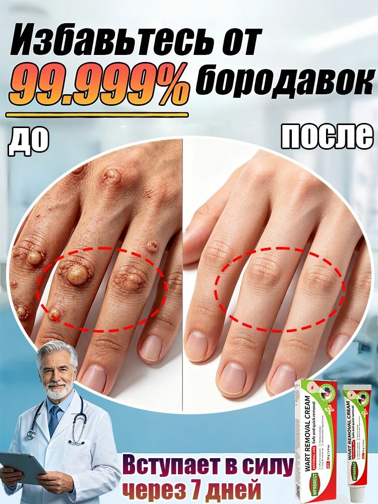 Крем от папиллом, бородавок и кондилом, быстрое удаление наростов на коже, для лица и тела, видимый результат за 7 дней,30 г против папиллом против кондилом