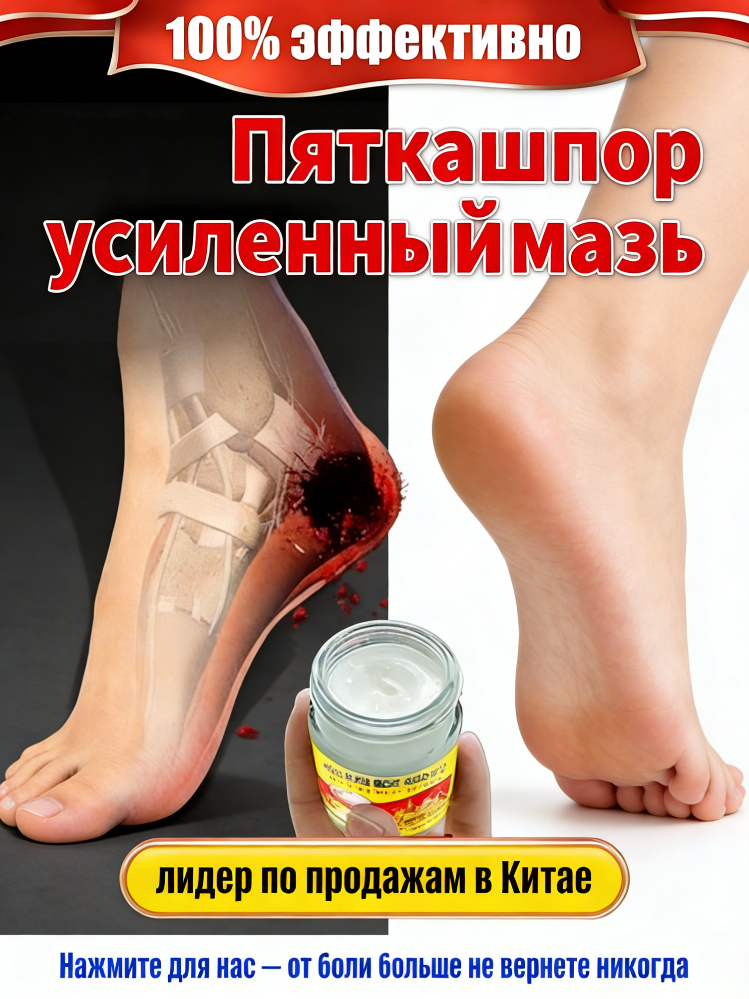 Китайский травяной крем от боли в пятке 55 г, при подошвенном фасциите и пяточных шпорах