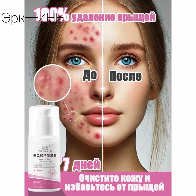 Прыщей Гель с 15% азелаиновой кислотой против чёрных точек и расширенных пор 100 г
