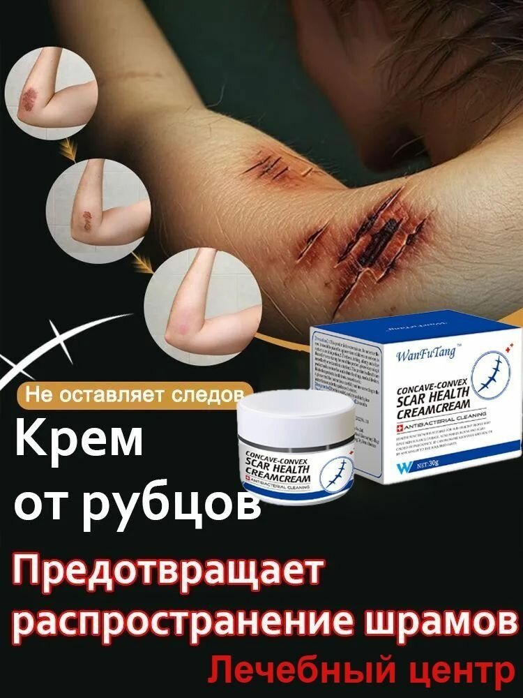 Крем от шрамов 30г, быстрая починка рубцов, от постакне, пигментации, Безопасно, без побочных эффектов, Крем от растяжек для лица и тела