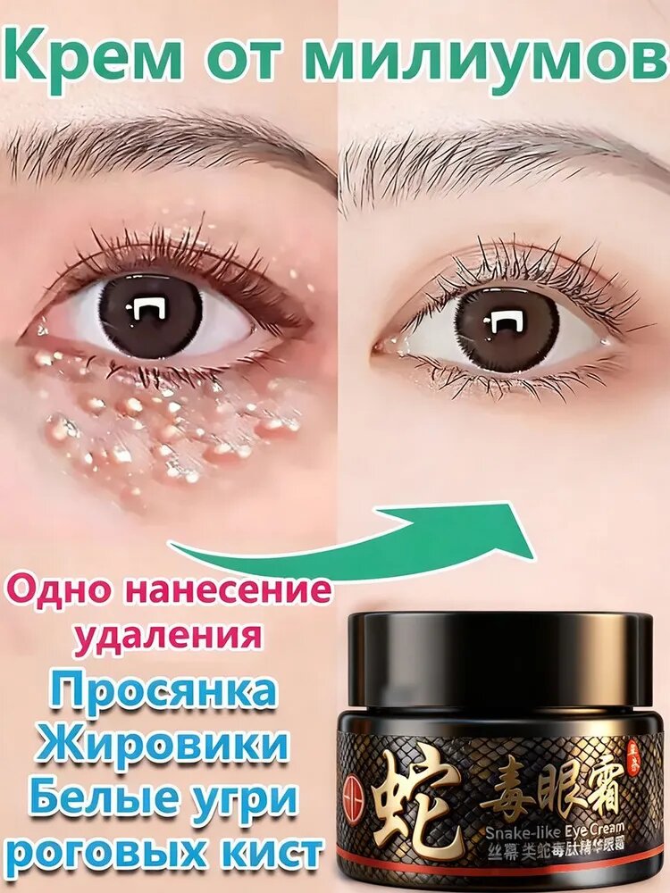 Эксклюзивный крем для устранения милиумов и липомы, показанный при подкожных жировых образованиях, отечности, целлюлите и фиброзном жировике