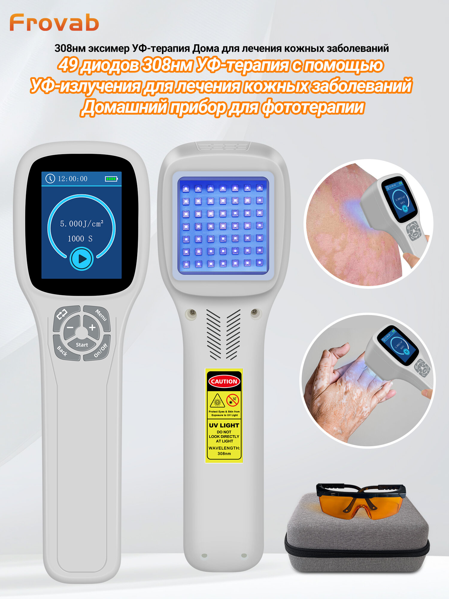 Портативный УФ облучатель Frovab 308нм 49 диода, использование дома, терапия кожных болезней взрослых разных стадий